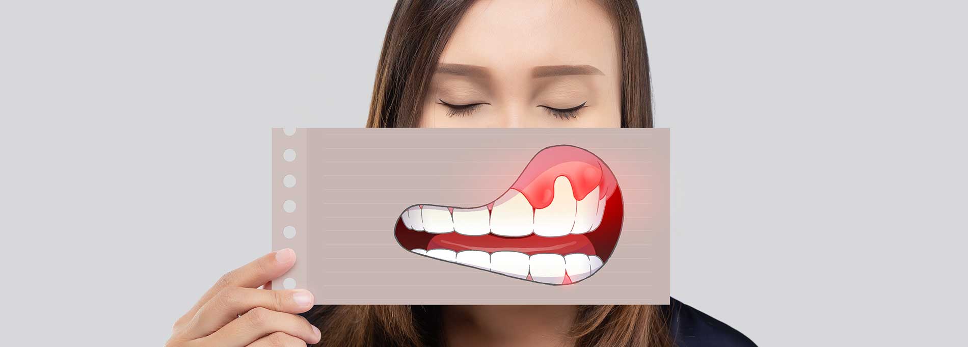 Gum Treatment in Rancho Cucamonga | Healthy Gums and Smile